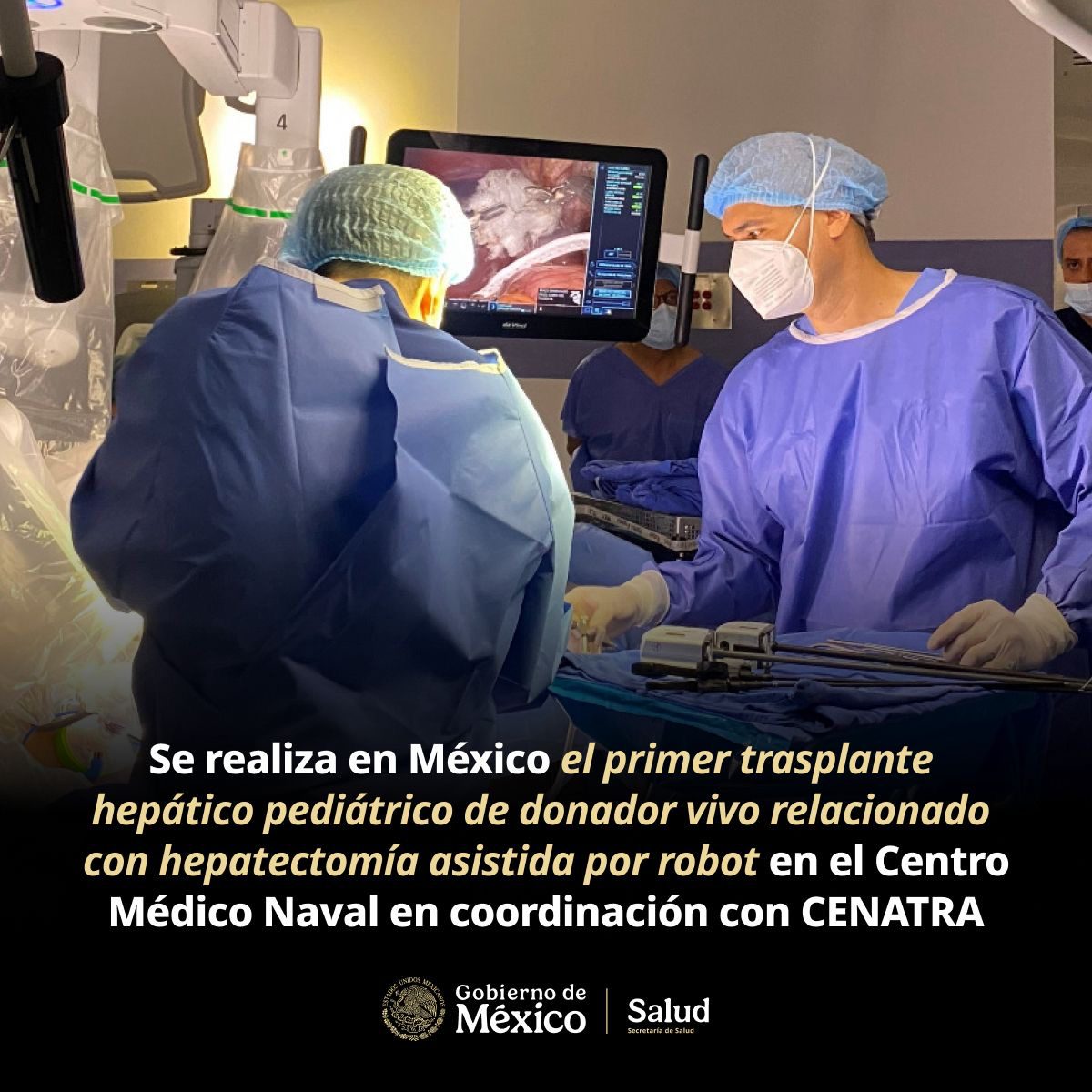 Primer trasplante hepático pediátrico de donador vivo relacionado ...